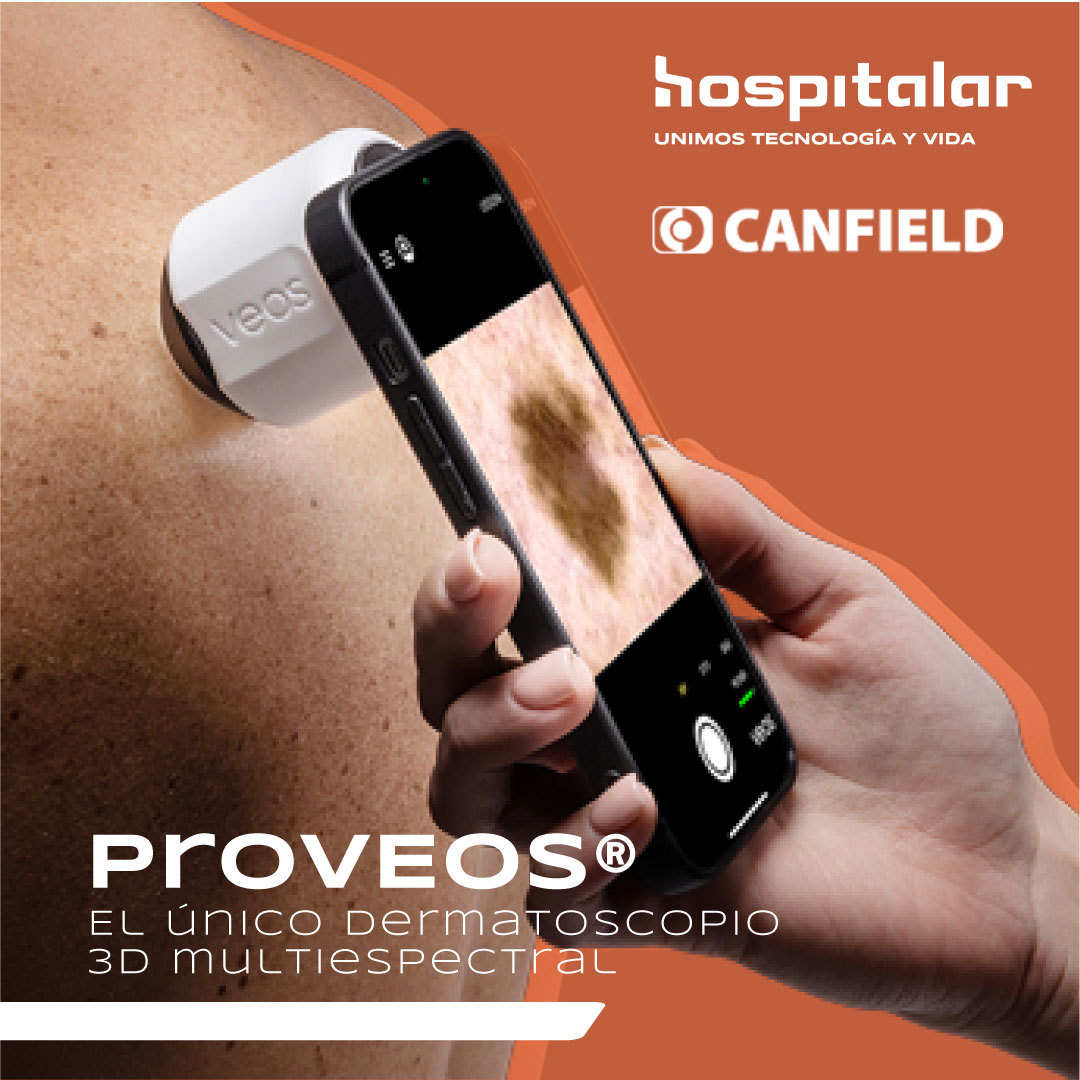 ¡Descubre el futuro con el dermatoscopio proVEOS®! - Hospitalar Venezuela