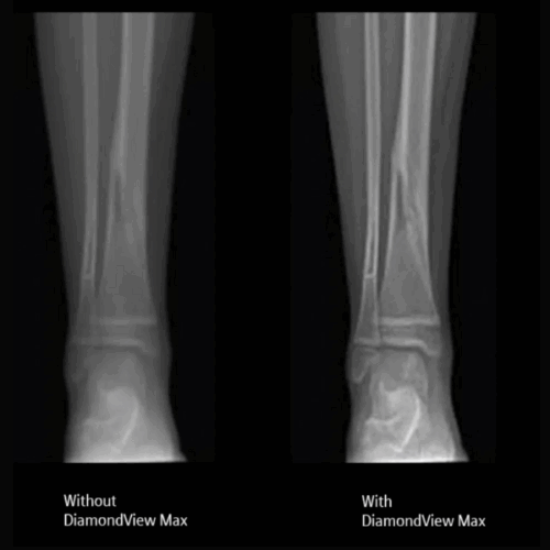 Elara Max - Hospitalar Venezuela